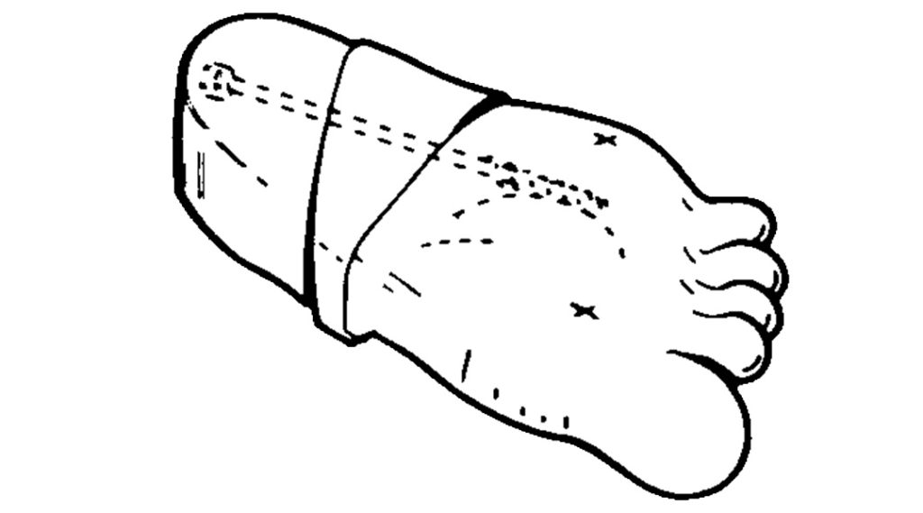 Orthotic Posting - Allied OSI Labs