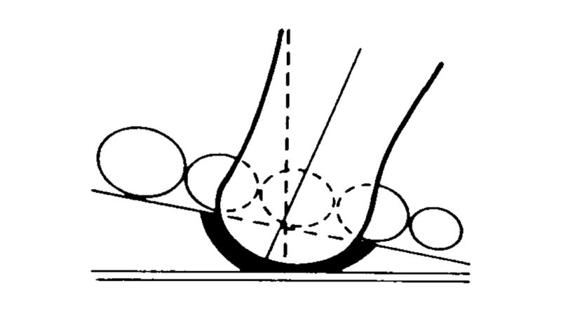 Orthotic Posting - Allied OSI Labs